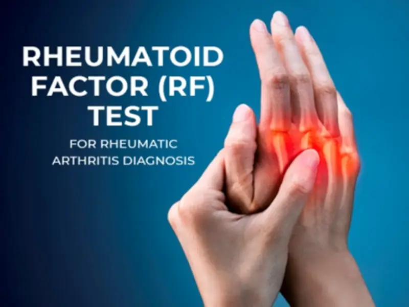 آزمایش RF یا فاکتور روماتوئید - آزمایشگاه جردن